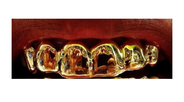 14k gold Overlay Removable gold teeth caps Grillz & mold kit 6 teeth ...