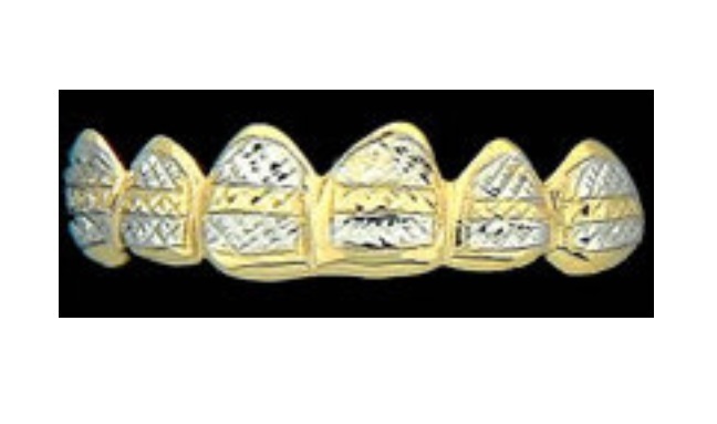 14k gold Overlay Removable gold teeth caps Grillz & mold kit 6 teeth ...