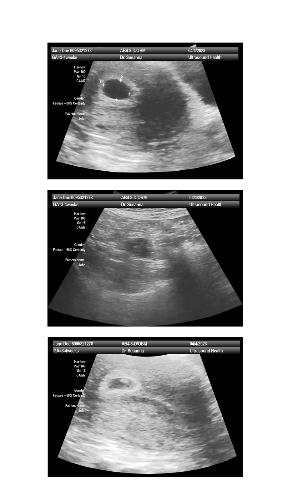 FakeaBaby Prank Fake Ultrasound 3-4 Week Fake Sonogram Emailed Today ...